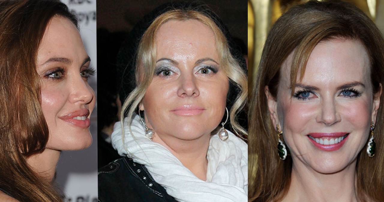 Miss botox - Styl w INTERIA.PL