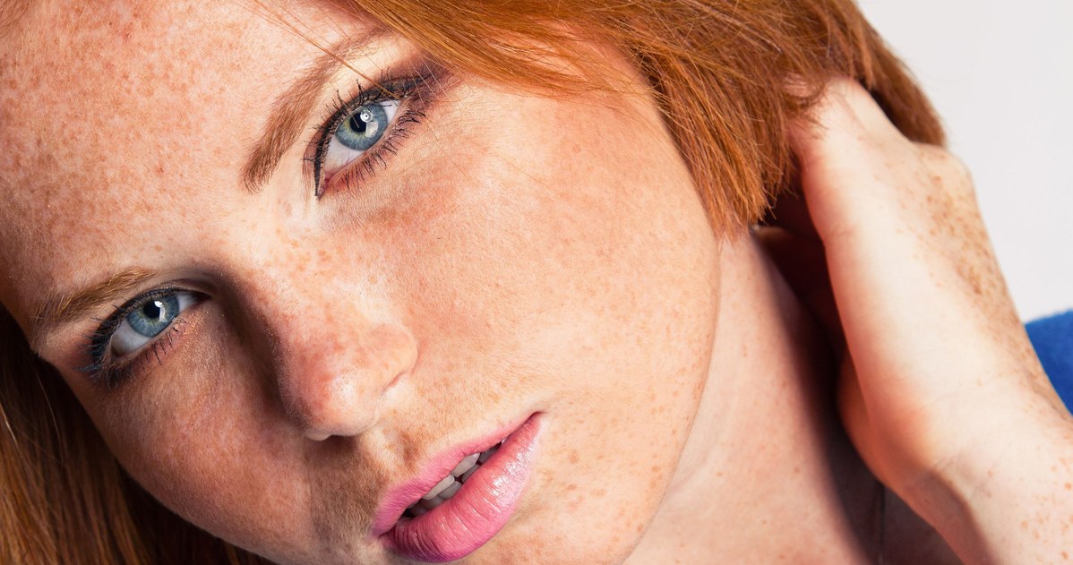 Pielęgnacja skóry: Czy można usunąć piegi? - Styl w INTERIA.PL