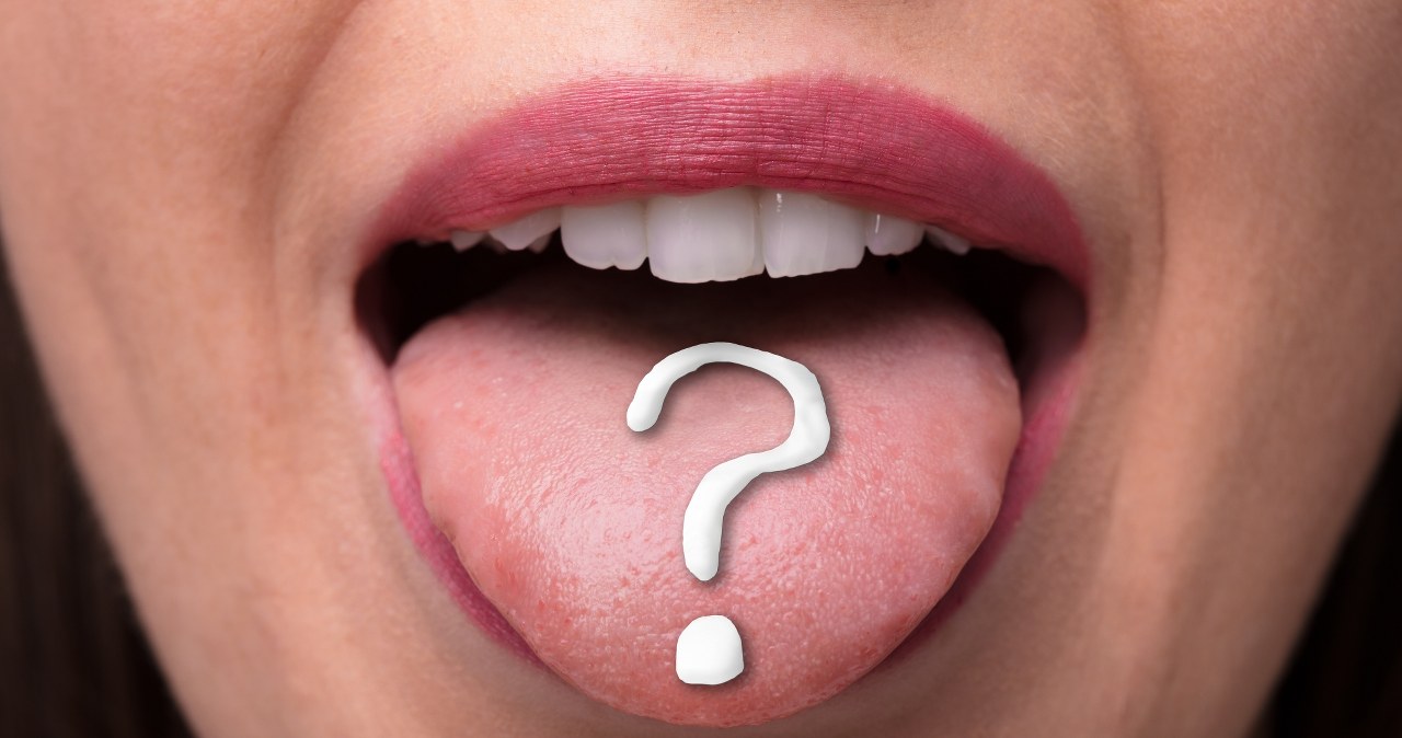 Biały nalot na języku – co oznacza? - Styl w INTERIA.PL