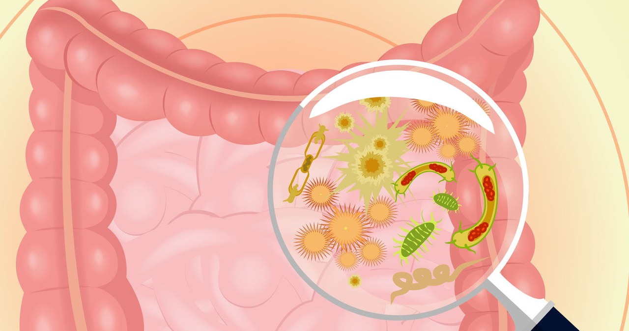Zespół SIBO: Przyczyny, objawy, leczenie - Kobieta w INTERIA.PL