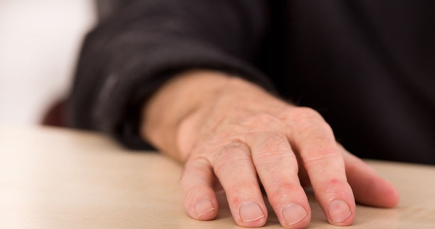 O czym świadczą pałeczkowate palce? - Kobieta w INTERIA.PL