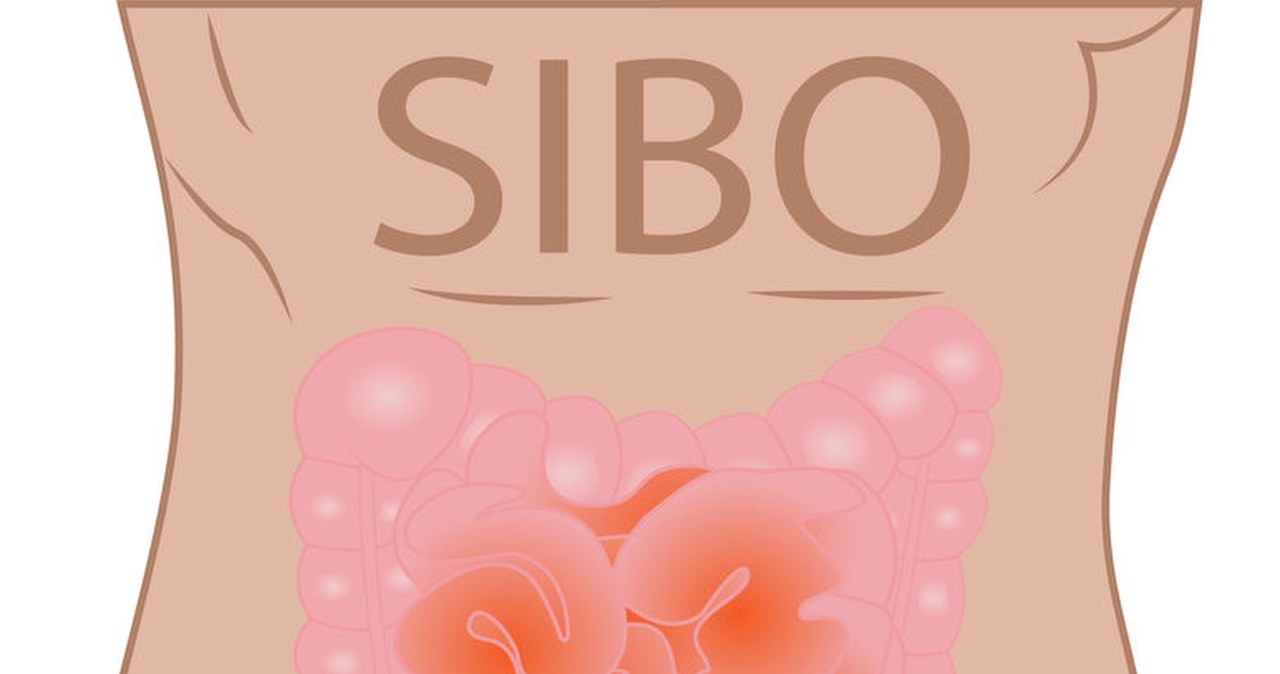 Zespół SIBO: Objawy, przyczyny, dieta - Kobieta w INTERIA.PL