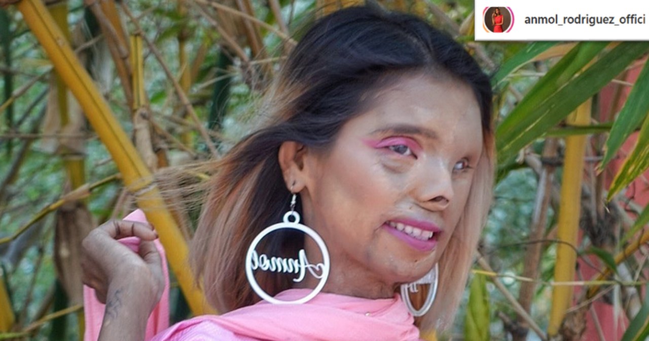Anmol Rodriguez. Modelka, która cudem ocalała - Styl w INTERIA.PL