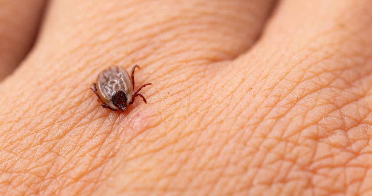 Neuroborelioza: Przyczyny, objawy i leczenie - Kobieta w INTERIA.PL