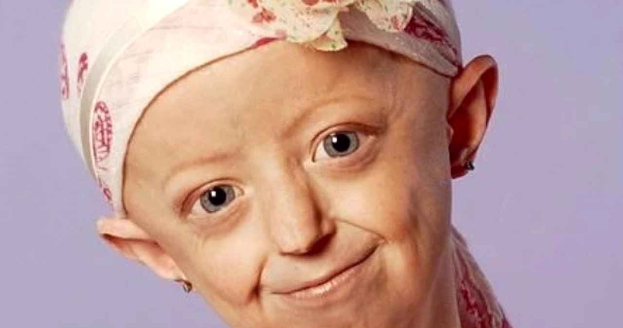 Hayley Okines: Dziecko w ciele starca - Styl w INTERIA.PL