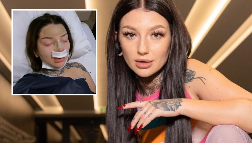 Ekipa Friza: Marcysia Ryskala zoperowała nos - pomponik.pl