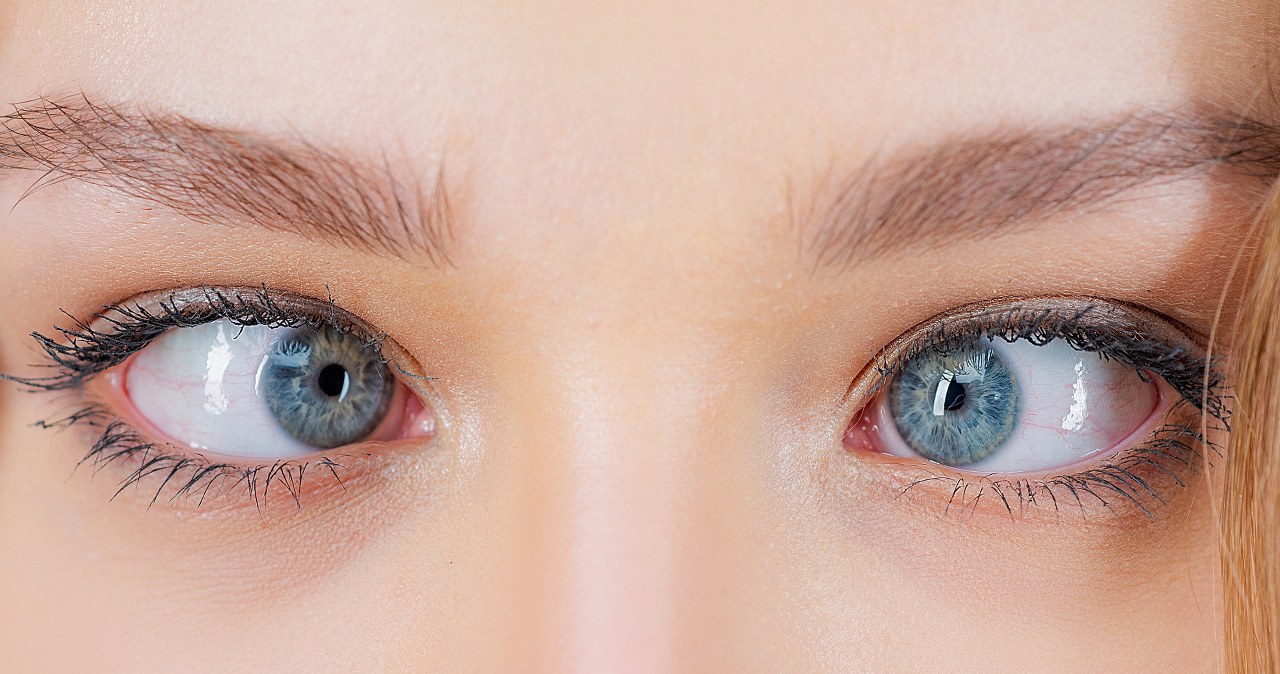 Zez - pierwsze objawy. Jak rozpoznać zeza? Od czego się bierze zez ...