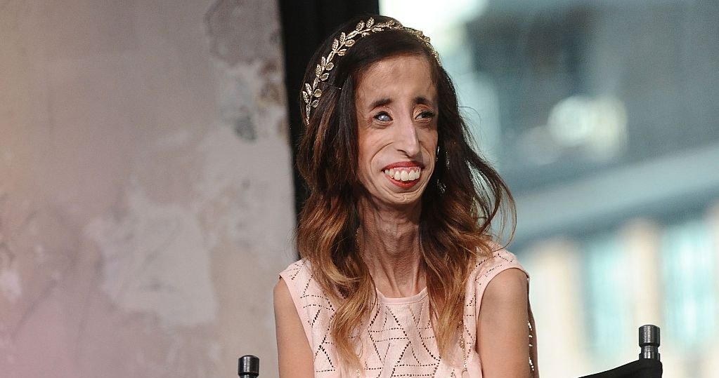 Lizzy Velasquez: nazywano ją "najbrzydszą kobietą na świecie" - Styl w ...