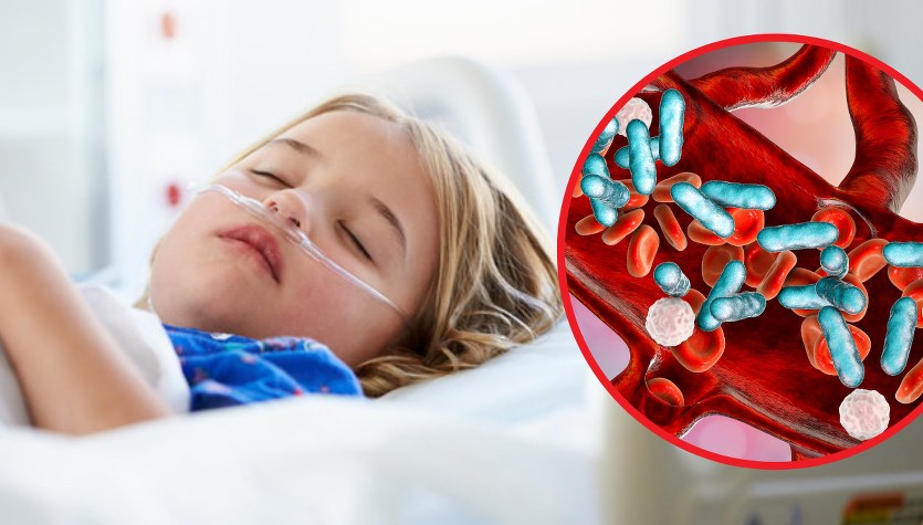 Co to jest sepsa? Czy jest groźna? Jak objawia się sepsa? - Zdrowie w ...