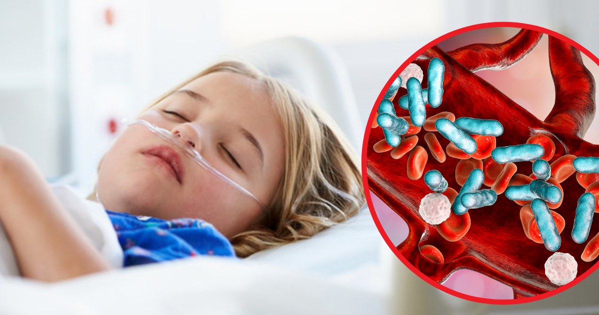 Co to jest sepsa? Czy jest groźna? Jak objawia się sepsa? - Zdrowie w ...