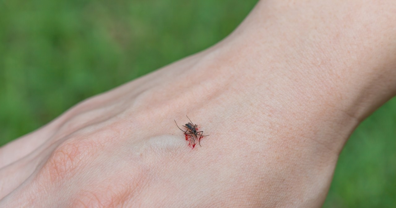 Jak rozpoznać, co mnie ugryzło? Ślad może ci wiele powiedzieć - Zielona ...