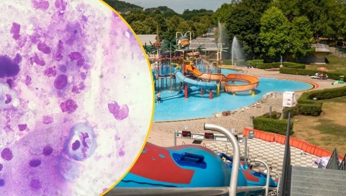 Ameba w basenach termalnych w Szturowie na Słowacji - RMF 24