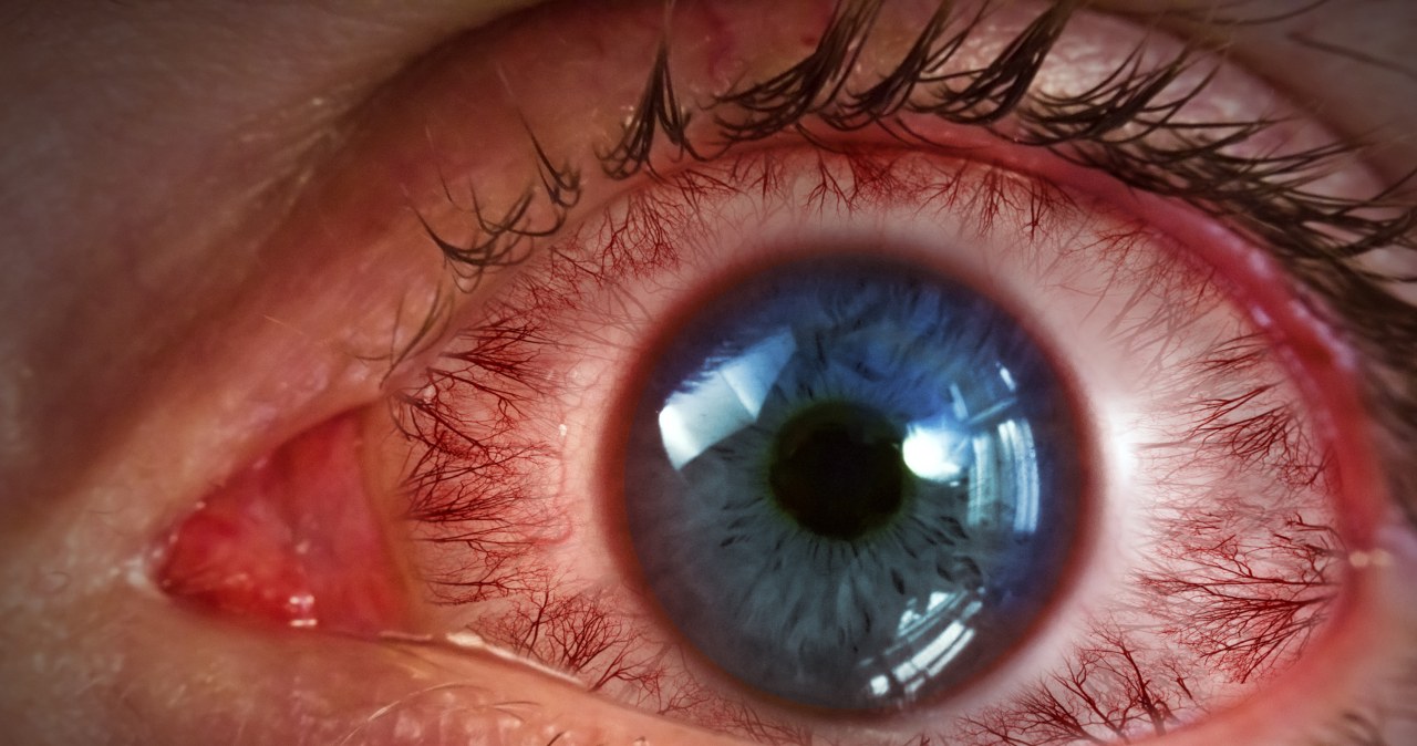 Czerniak. Skóra mu nie wystarcza - Styl w INTERIA.PL