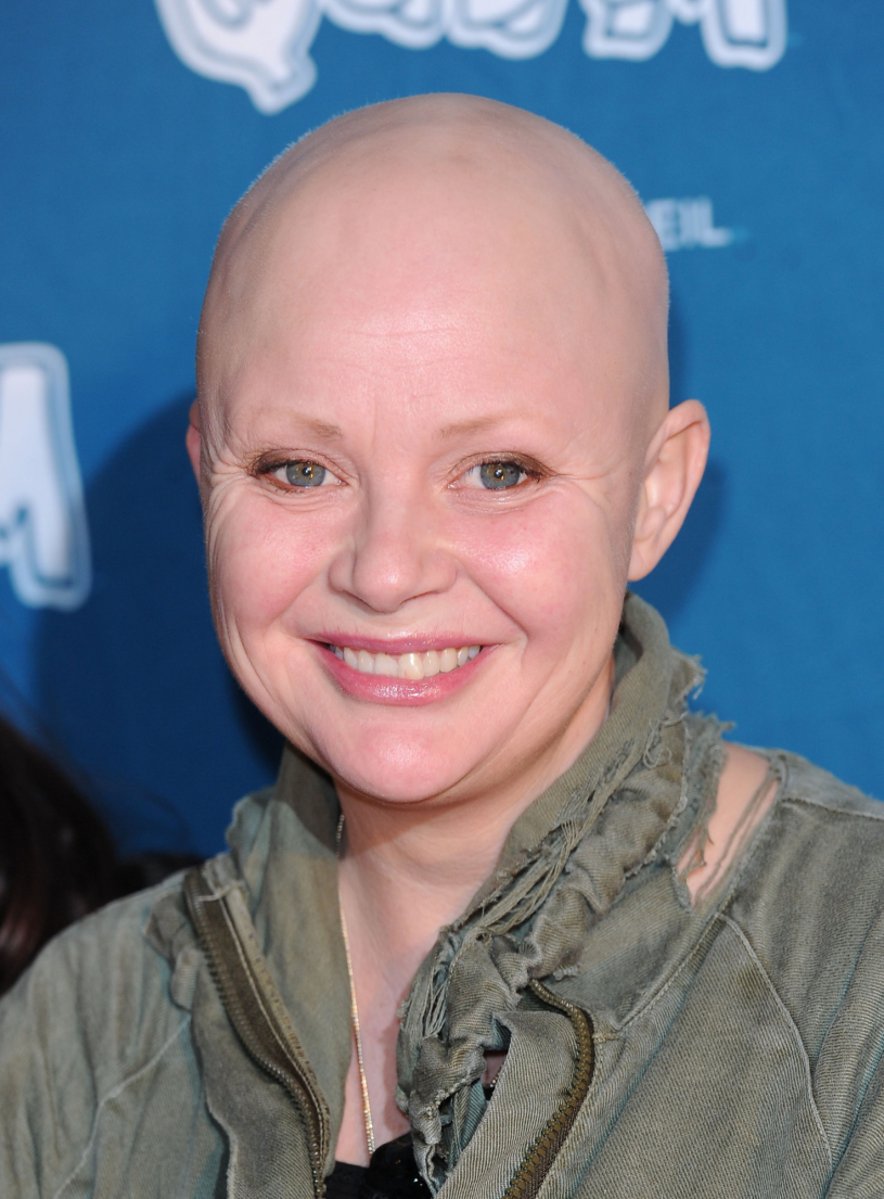 Gail Porter cierpi na straszną chorobę! Dziennikarka straciła wszystkie ...