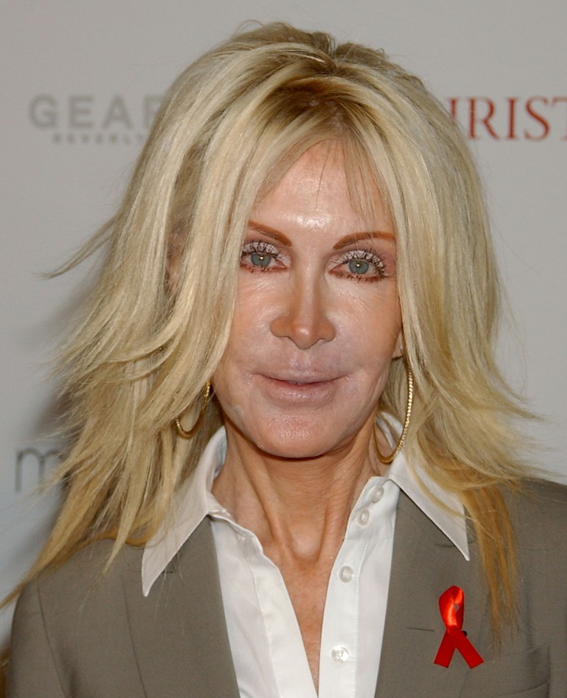 Joan Van Ark: Kiedyś gwiazda, dziś ofiara operacji plastycznych - Świat ...