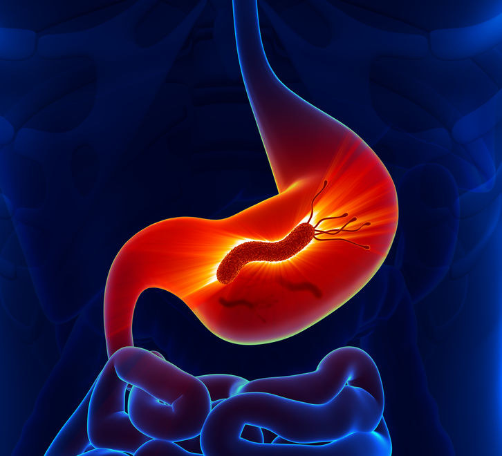 Dieta przy zakażeniu bakterią Helicobacter pylori - Porady w INTERIA.PL Dieta przy zakażeniu bakterią Helicobacter pylori - Porady w INTERIA.PL